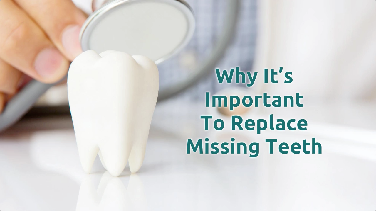 Why It’s Important To Replace Missing Teeth | Q1 Dental